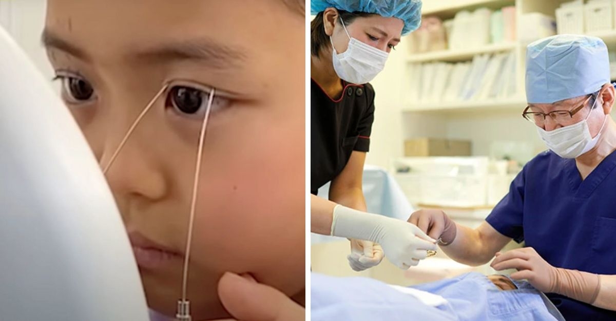 Giới trẻ Nhật chọn PTTM vì ám ảnh ngoại hình | KILALA